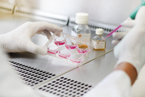 PL BioScience » Broadest portfolio of Human Platelet Lysate